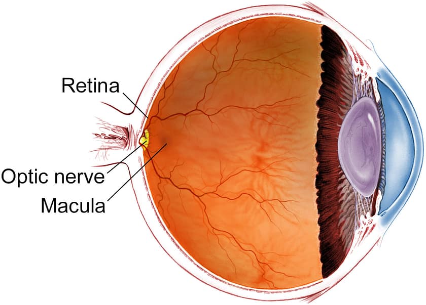 Medical Retina - Raaj Eye Hospital
